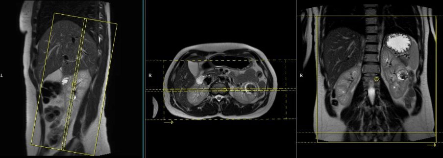 MRI of the Kidneys — Cost & Complete Guide | EVE Healthcare